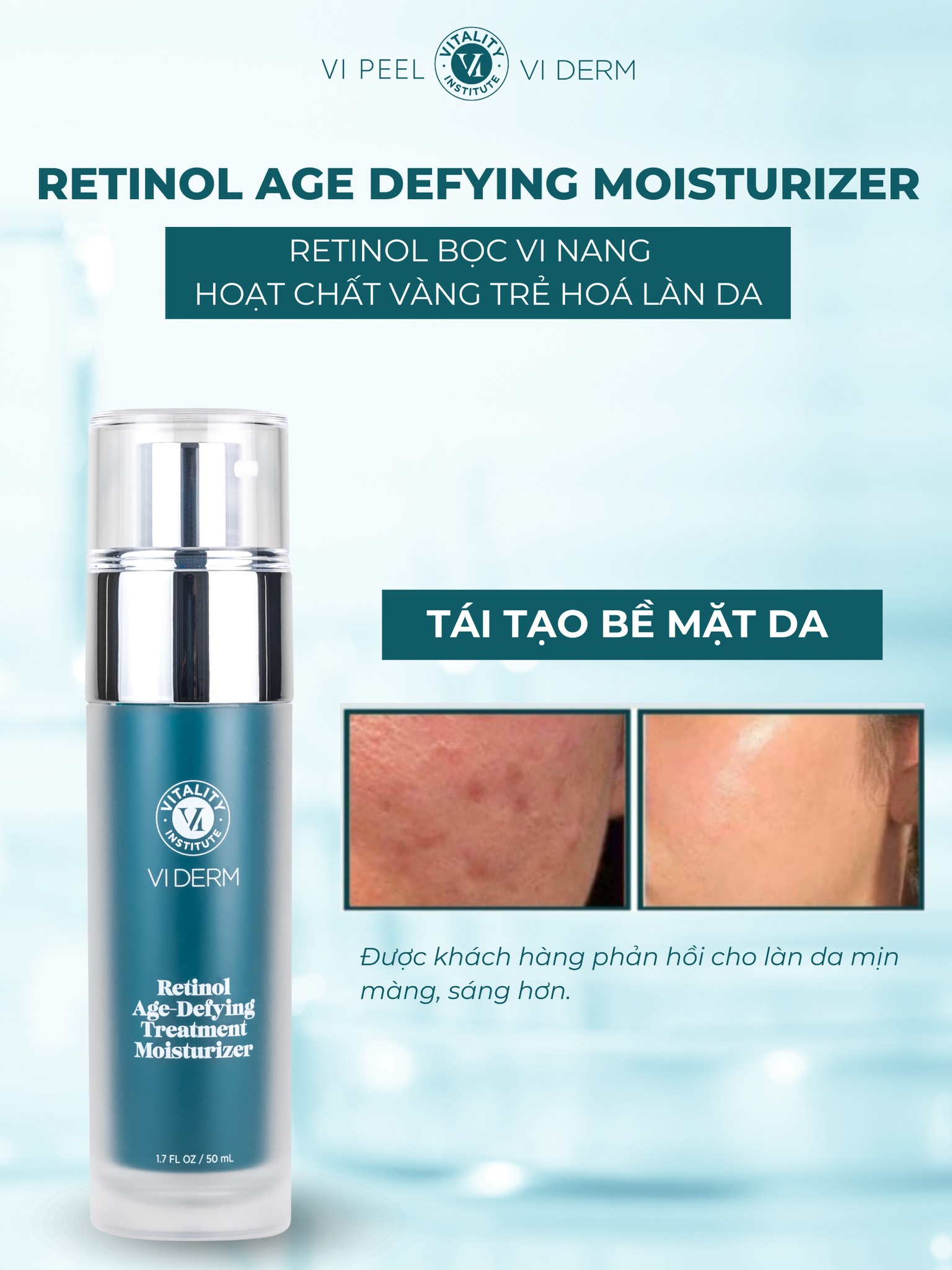 Kem Dưỡng Chống Lão Hóa VI Derm Retinol Age-Defying Treatment ...