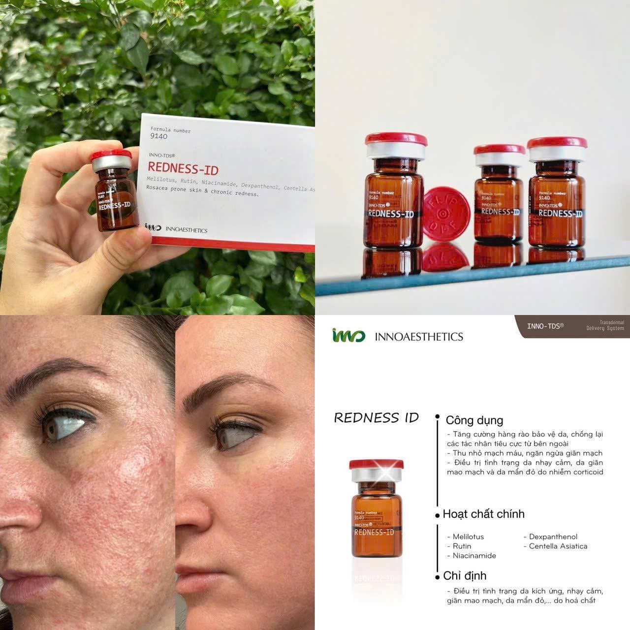 Meso Innoathestics REDNESS-ID giảm đỏ, phục hồi da yếu